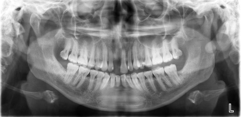 Dental Radiography – Imaging Department HGS